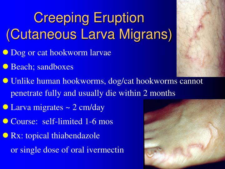 PPT - A Rash Overview of Tropical Skin Diseases (and other things ...