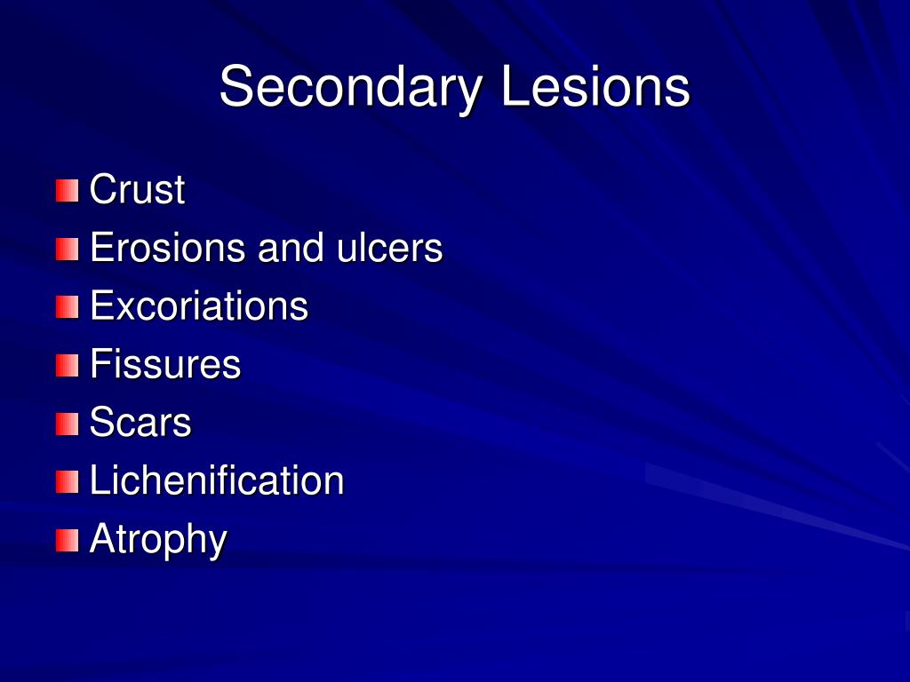 PPT - Dermatologic Manifestations of Chronic Disease PowerPoint ...