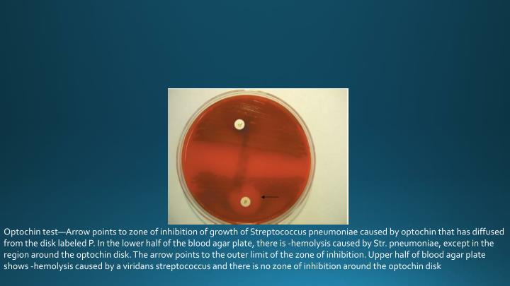 PPT - Streptococcus pneumoniae PowerPoint Presentation - ID:2361806