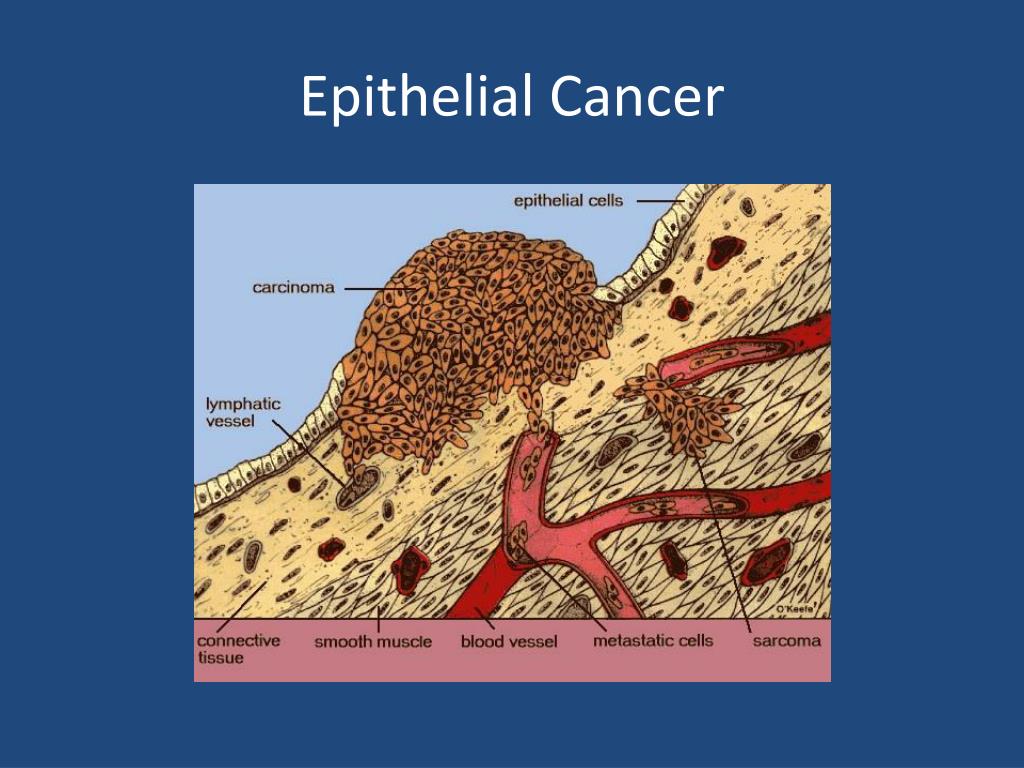 PPT - Inhibition of Cancer cells by Iressa, an EGFR Tyrosine Kinase ...