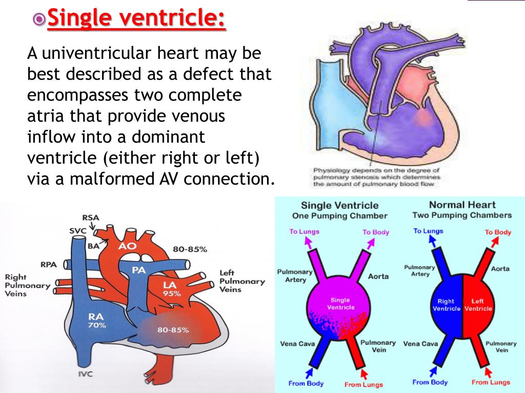 PPT - Congenital Anomalies of the heart PowerPoint Presentation, free ...