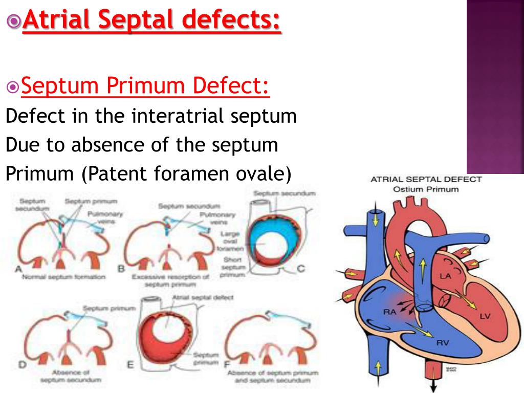 PPT - Congenital Anomalies of the heart PowerPoint Presentation, free ...