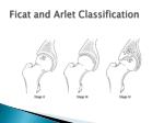PPT - Osteonecrosis of the Hip: Diagnosis and Management of Ficat I and ...