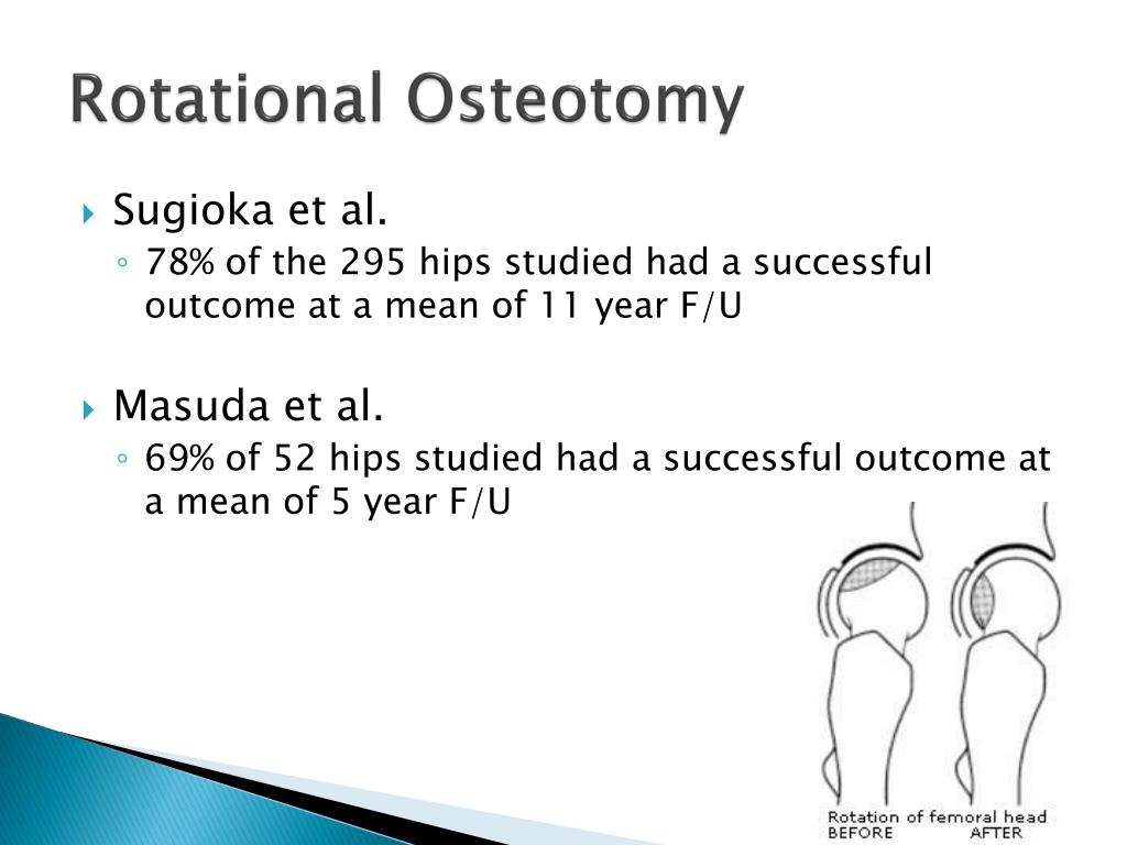 PPT - Osteonecrosis of the Hip: Diagnosis and Management of Ficat I and ...