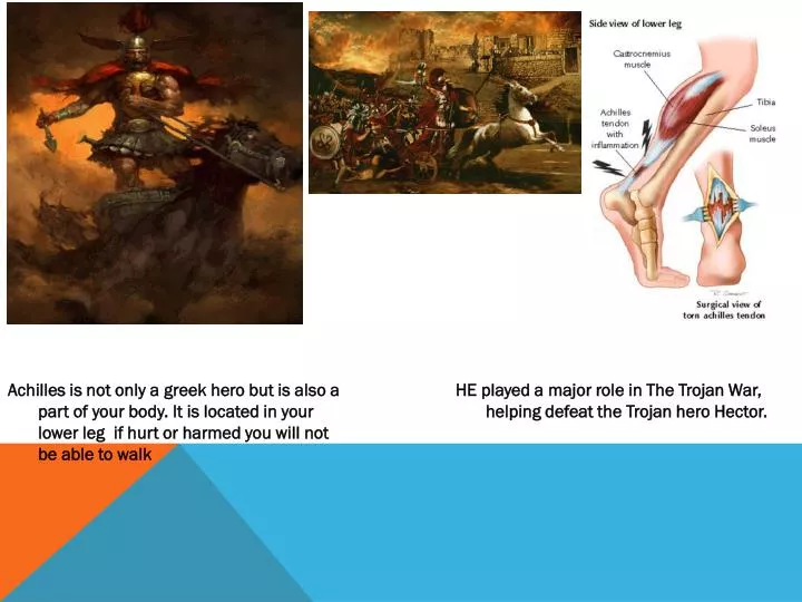 PPT - ACHILLES PowerPoint Presentation, free download - ID:2364294