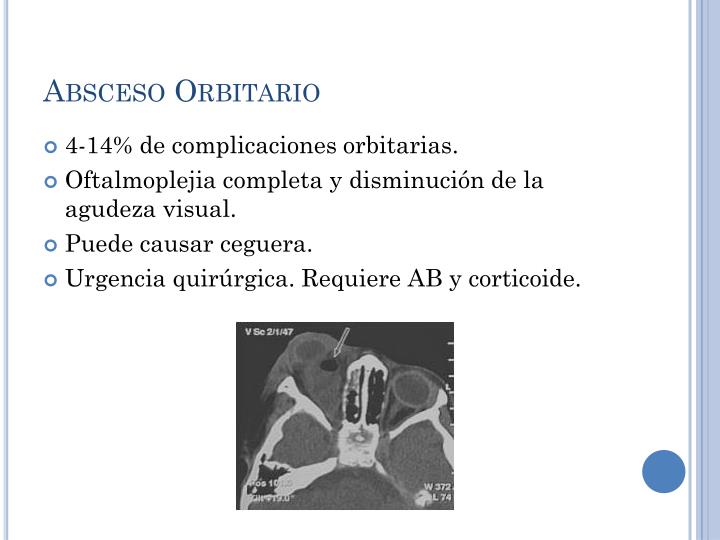 PPT - Rinosinusitis PowerPoint Presentation - ID:2364560