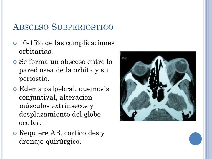 PPT - Rinosinusitis PowerPoint Presentation - ID:2364560