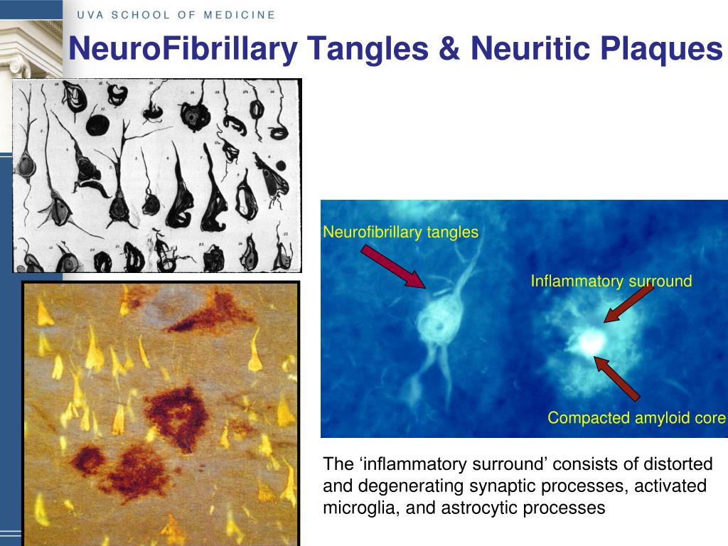 PPT - Advances in Alzheimer's Disease: New Technologies and New Ethical ...