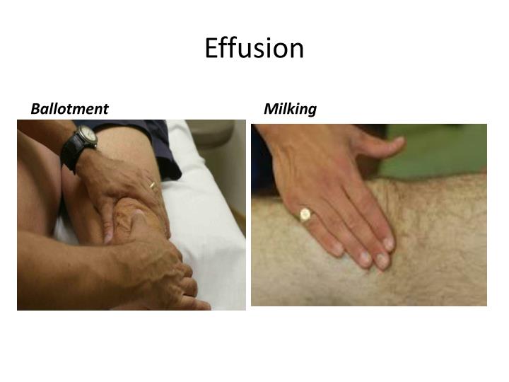 PPT - Knee Examination PowerPoint Presentation - ID:2365304