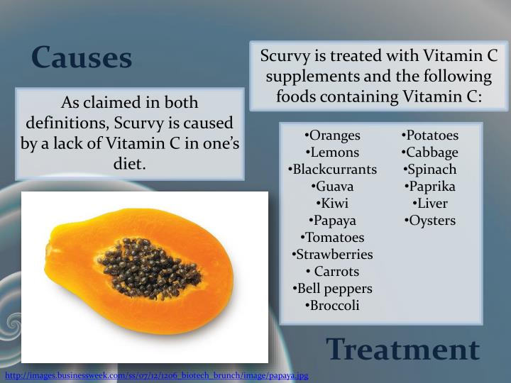 PPT - Scurvy PowerPoint Presentation - ID:2366391