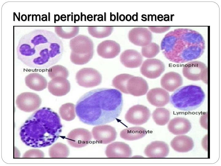 PPT - Medical Parasitology PowerPoint Presentation - ID:2368422