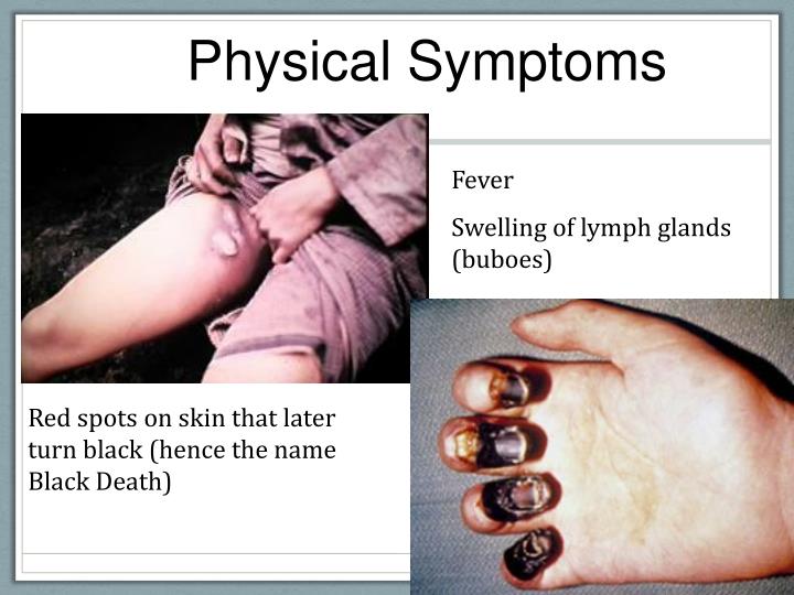 PPT - The Plague Black Death- Bubonic Plague PowerPoint Presentation ...