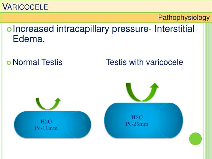 PPT - The Varicocele’s Impact over the Masculine Fertility PowerPoint ...