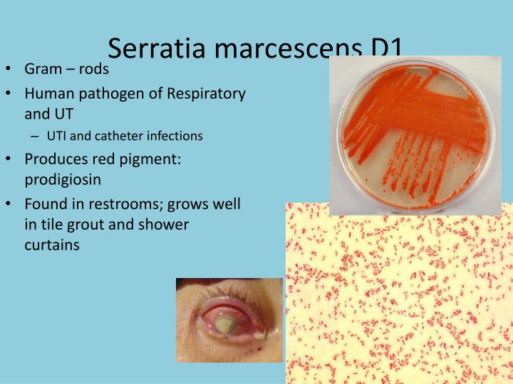 PPT - Bacterial Identification PowerPoint Presentation - ID:2368770