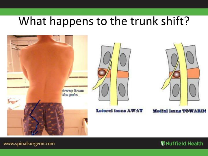 PPT - Sciatica Differential Diagnosis PowerPoint Presentation - ID:2368999