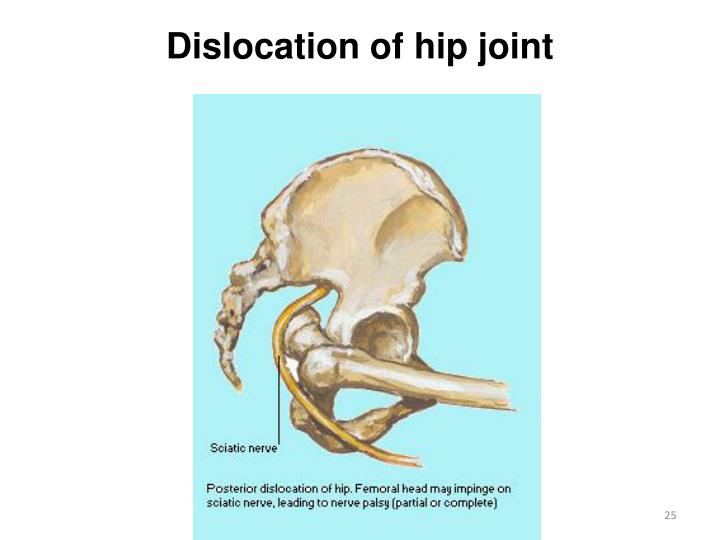 PPT - Femoral n. PowerPoint Presentation - ID:2369198