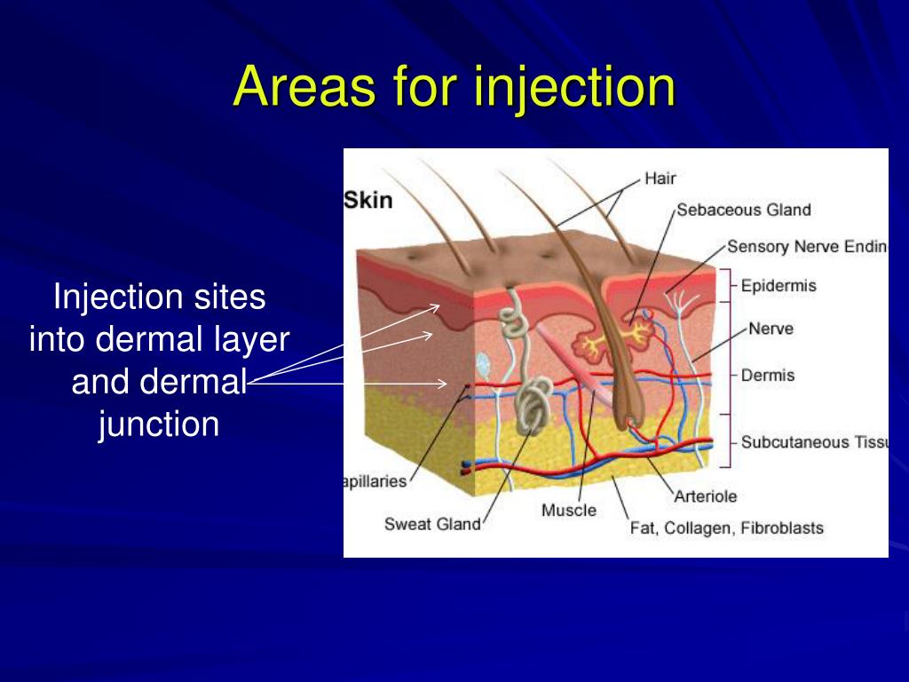 PPT - Mr Basim Matti FRCS London Dr Peter Everts PhD Eindhoven, Holland ...