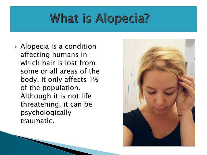 PPT - ALOPECIA AREATA PowerPoint Presentation - ID:2370966