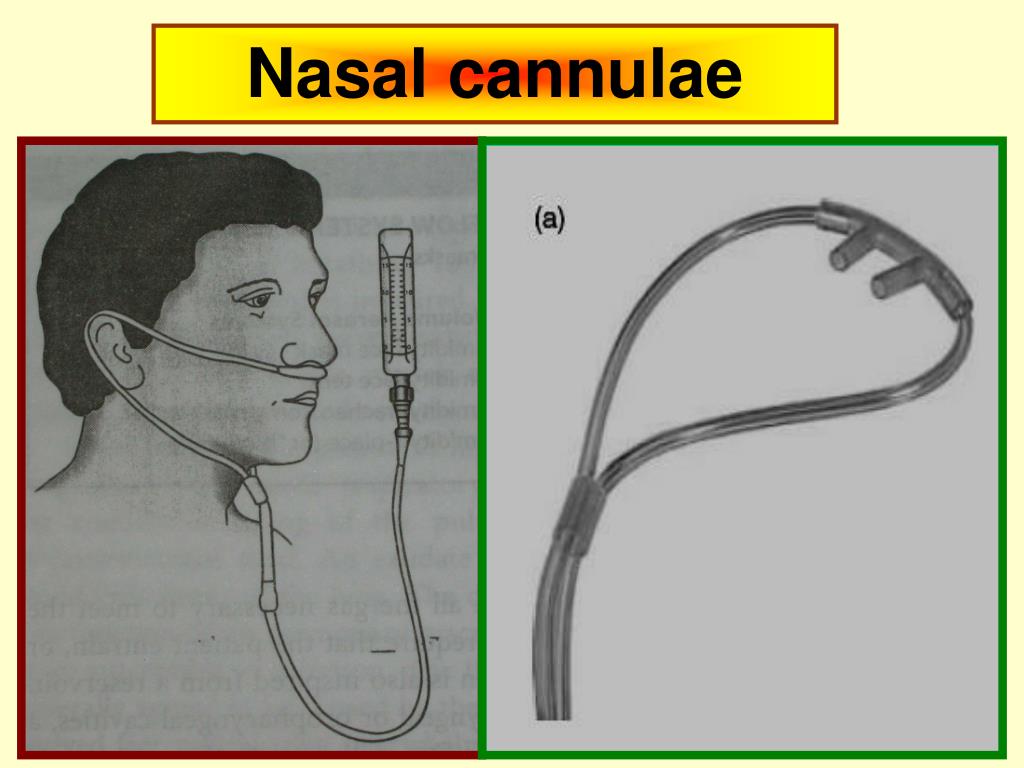 PPT - Oxygen therapy in acutely ill patients PowerPoint Presentation ...