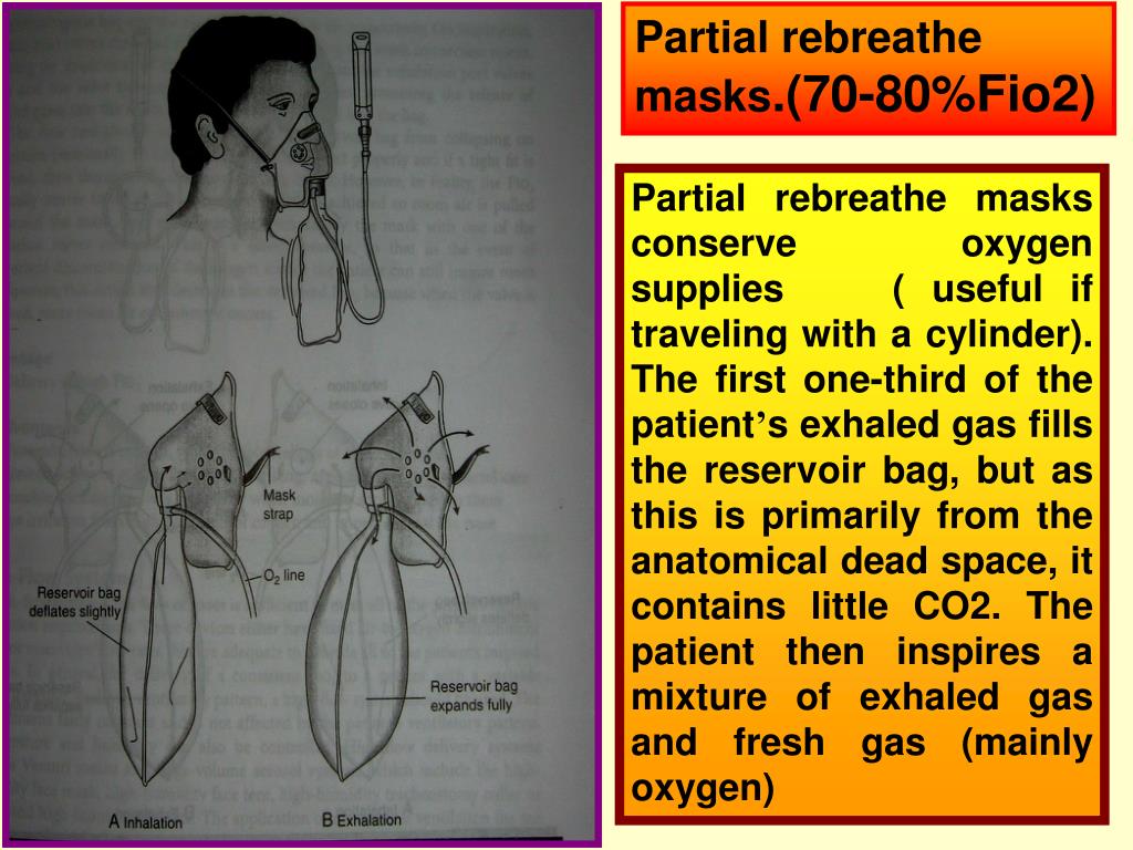 PPT - Oxygen therapy in acutely ill patients PowerPoint Presentation ...
