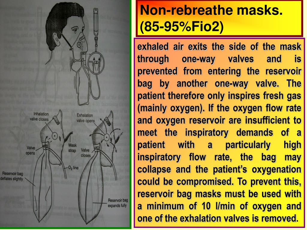 PPT - Oxygen therapy in acutely ill patients PowerPoint Presentation ...