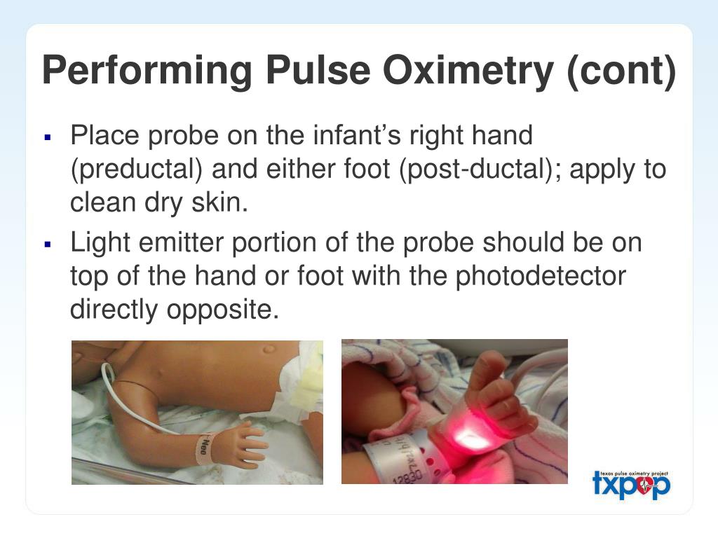 PPT - Screening for Critical Congenital Heart Disease in the Apparently ...