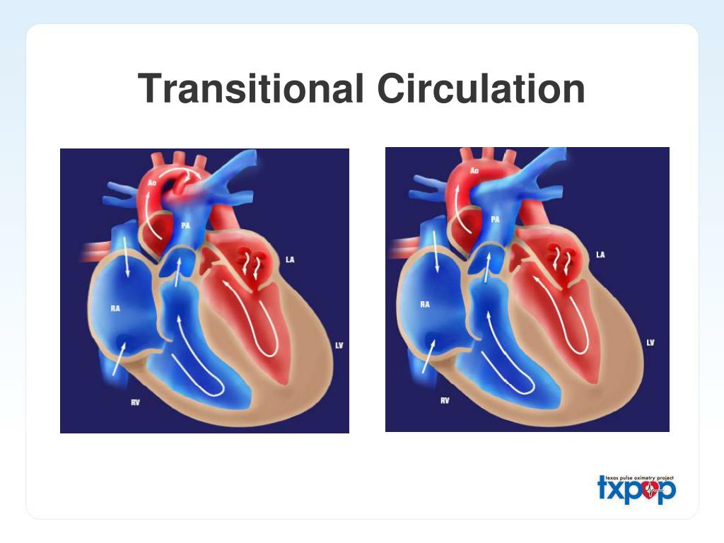 PPT - Screening for Critical Congenital Heart Disease in the Apparently ...