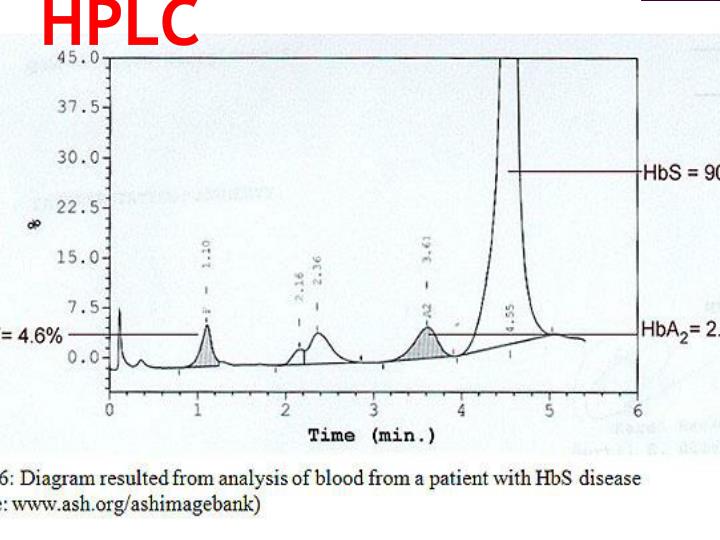 PPT - Hemoglobin Electrophoresis PowerPoint Presentation - ID:2372418