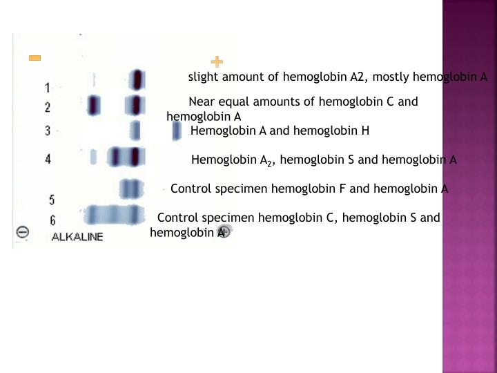 PPT - Hemoglobin Electrophoresis PowerPoint Presentation - ID:2372418