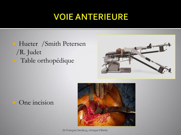 PPT - PROTHESE TOTALE DE HANCHE ET REEDUCATION PowerPoint Presentation ...