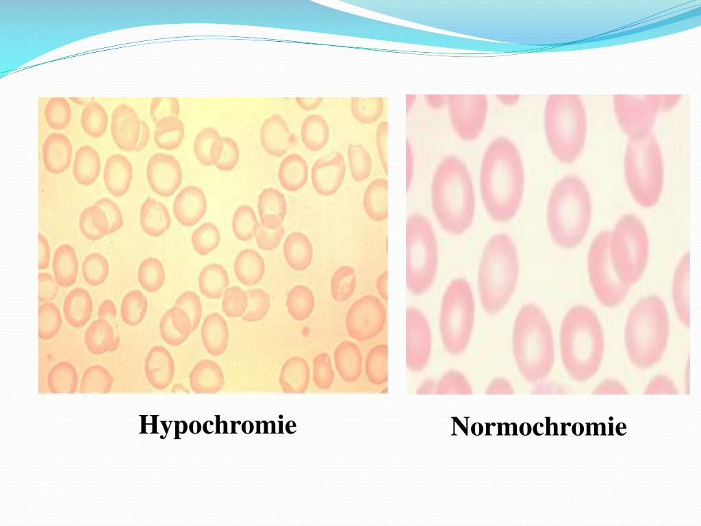 PPT - TP 3 ème Année Pharmacie Identification des cellules sanguines ...