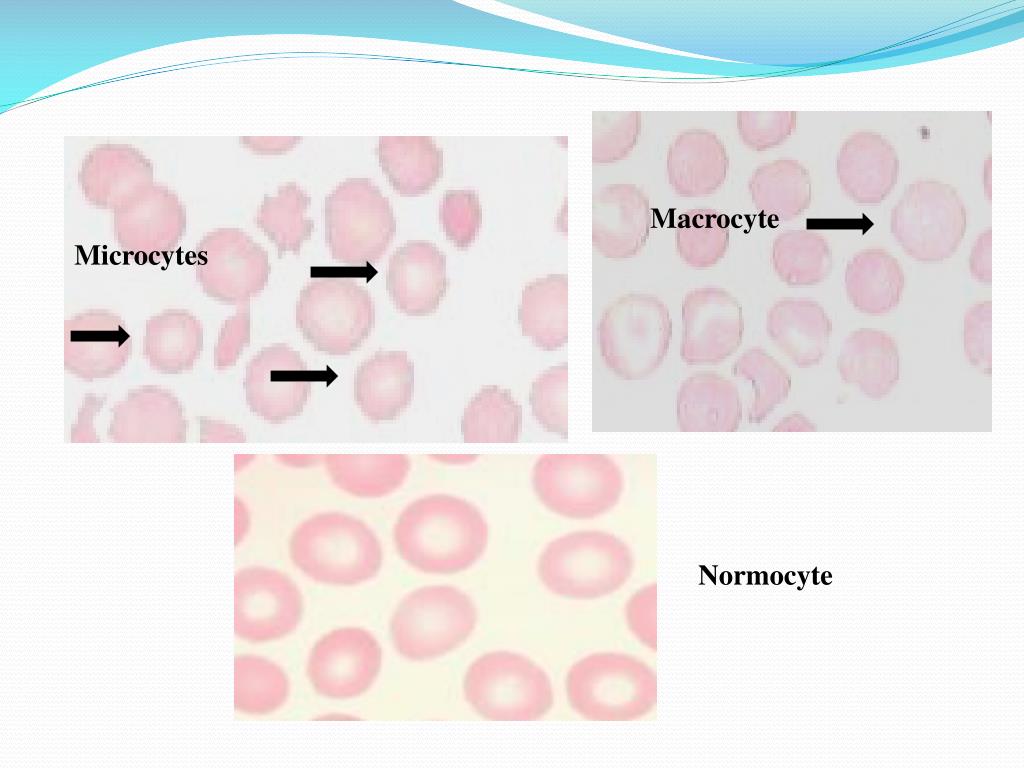 PPT - TP 3 ème Année Pharmacie Identification des cellules sanguines ...