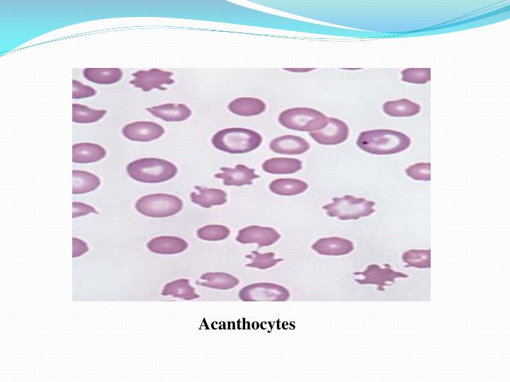 PPT - TP 3 ème Année Pharmacie Identification des cellules sanguines ...