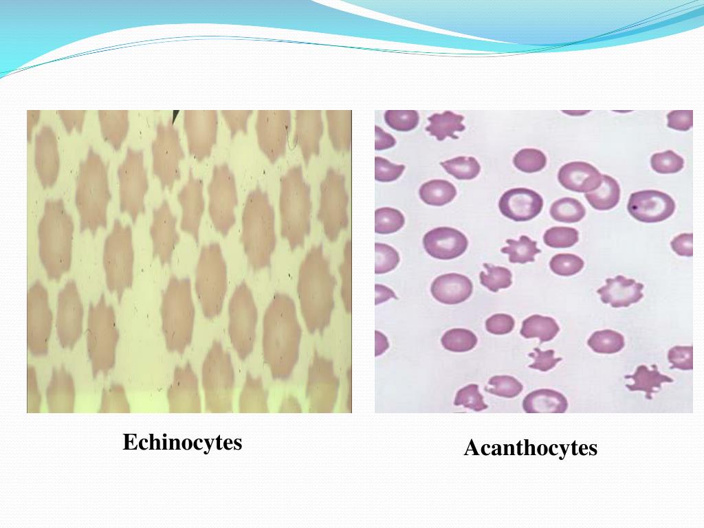 PPT - TP 3 ème Année Pharmacie Identification des cellules sanguines ...