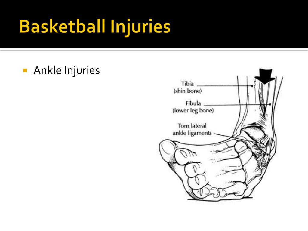 PPT - Oak Grove High School Basketball Guard Strength and Conditioning ...