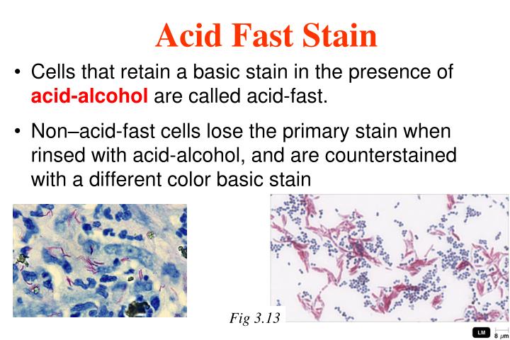 PPT - Ch 3: Observing Microorganisms Through a Microscope PowerPoint ...