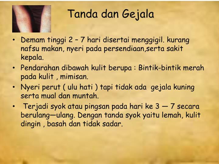 PPT - Demam Berdarah Dengue (DBD) PowerPoint Presentation - ID:2379398