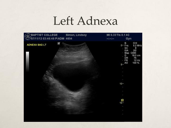 PPT - Pelvic PowerPoint Presentation - ID:2380240