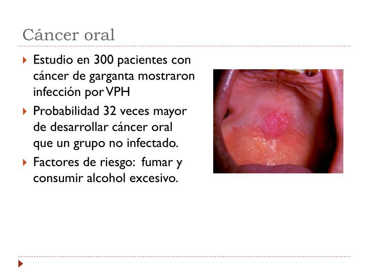 PPT - Virus del Papiloma Humano PowerPoint Presentation - ID:2380626
