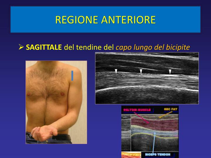 PPT - ANATOMIA PER IMMAGINI DELLA SPALLA: ECOGRAFIA PowerPoint ...
