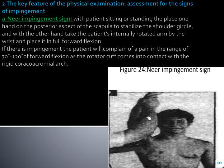PPT - Shoulder Impingement Syndrome PowerPoint Presentation - ID:2381718