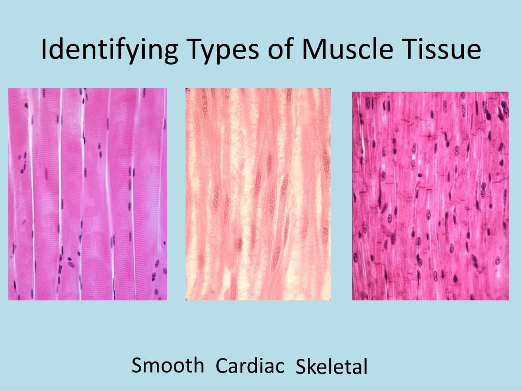PPT - Learning Target: Compare skeletal, smooth and cardiac muscle ...
