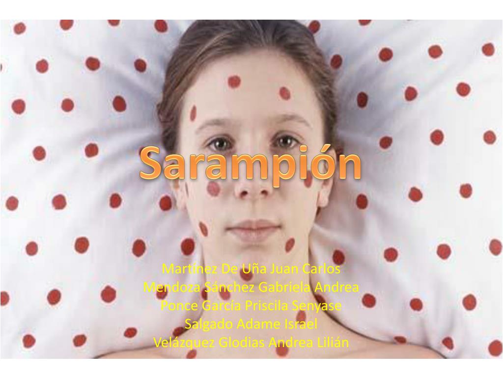 PPT - Sarampión PowerPoint Presentation, free download - ID:2382449