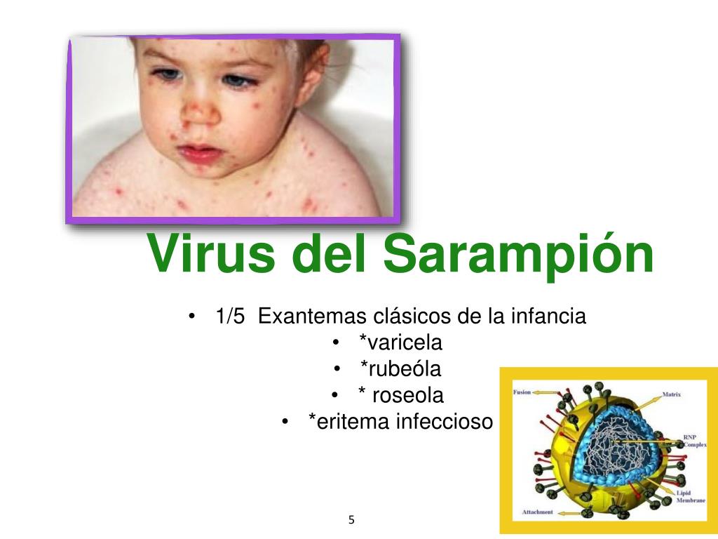 PPT - Sarampión PowerPoint Presentation, free download - ID:2382449