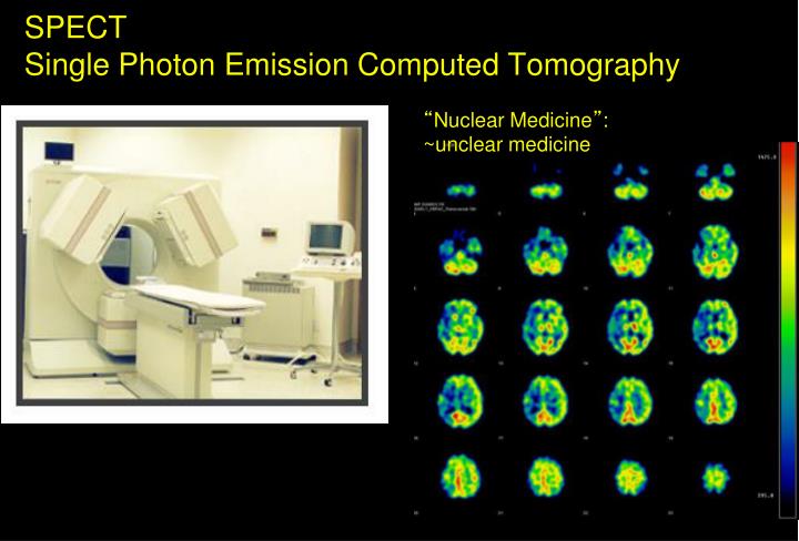 PPT - Principles of Neuroimaging PowerPoint Presentation - ID:2385975