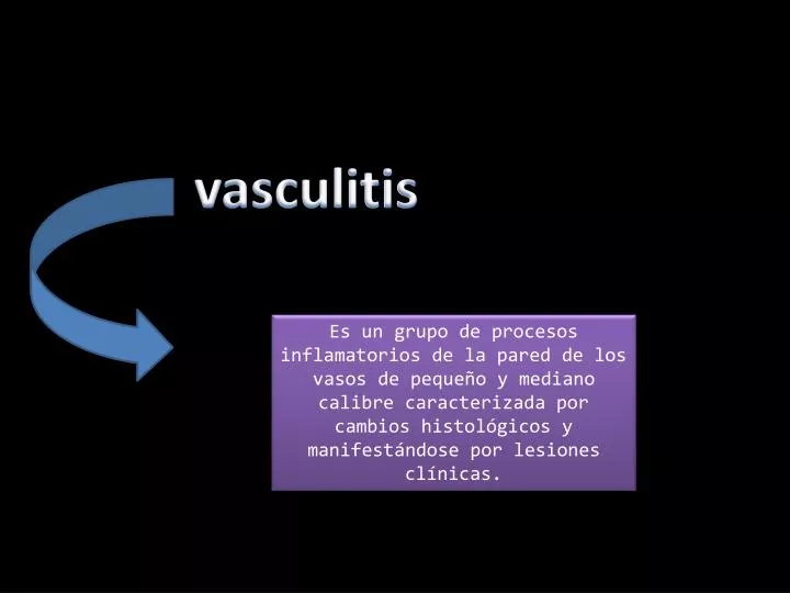 PPT - vasculitis PowerPoint Presentation, free download - ID:2390281