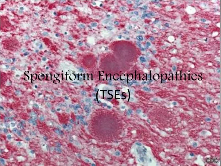 PPT - Spongiform Encephalopathies ( TSEs) PowerPoint Presentation, free ...