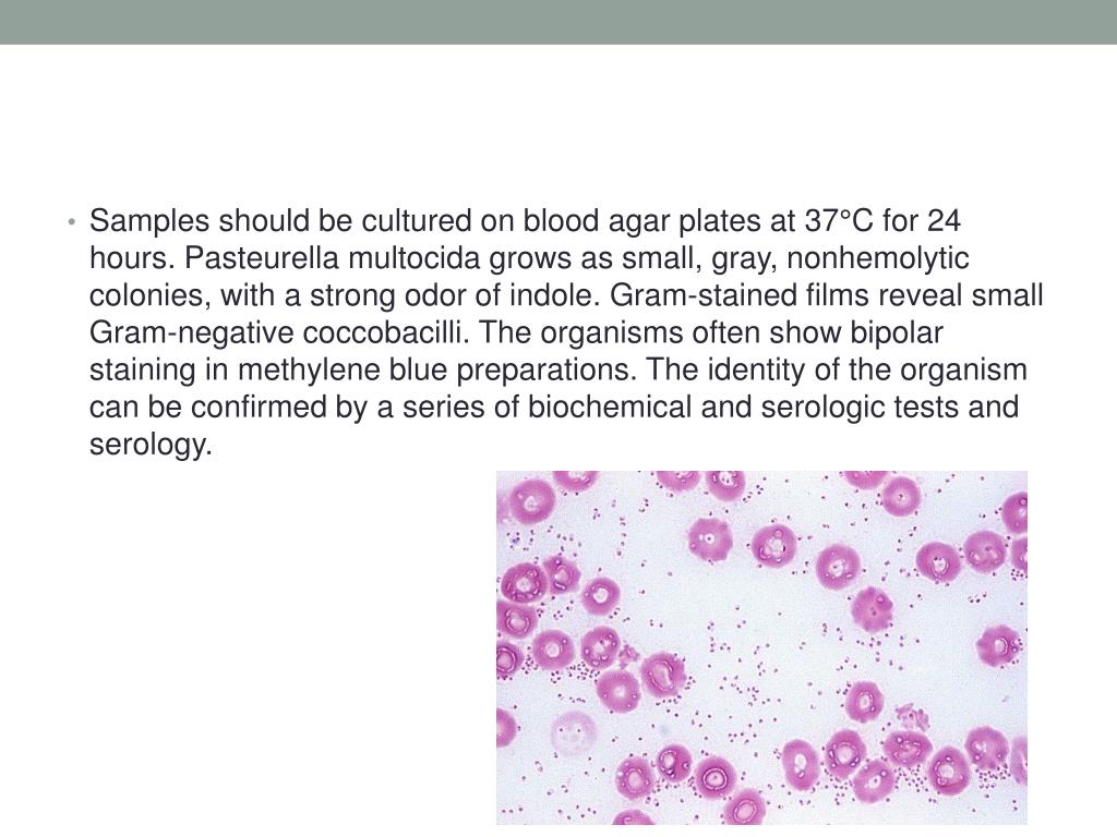 PPT - Yersinia,FRANCISELLA,PASTEURELLA,VIBRIO, CAMPYLOBACTER PowerPoint ...