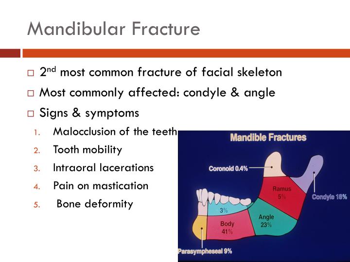 PPT - TRAUMA PowerPoint Presentation - ID:2392451