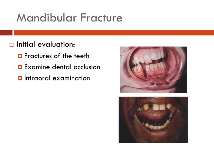 PPT - TRAUMA PowerPoint Presentation - ID:2392451